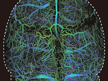 Optics & Photonics News - Fluorescence Microscopy Peers Deep in the Brain