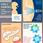Optics & Photonics News - Controlling Diabetes with Light