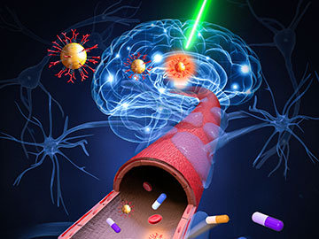 Optics & Photonics News - Lasers and Nanoparticles Open Blood–Brain Barrier