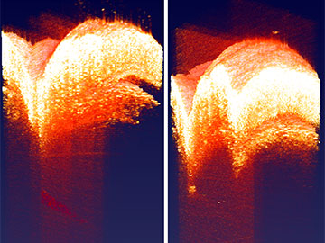 Optics & Photonics News - Dual-Axis OCT Goes Deeper