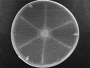 Optics & Photonics News - High-Resolution, Low-Dose X-Ray Microscopy
