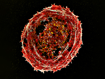 Optics & Photonics News - Super-Resolution Microscope Expands View of ...