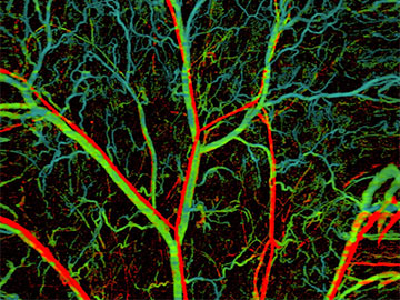 Optics & Photonics News - Photoacoustic Microscope Breaks Sensitivity ...