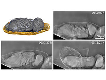 Optics & Photonics News - X-Ray Optics Boost High-Resolution Imaging